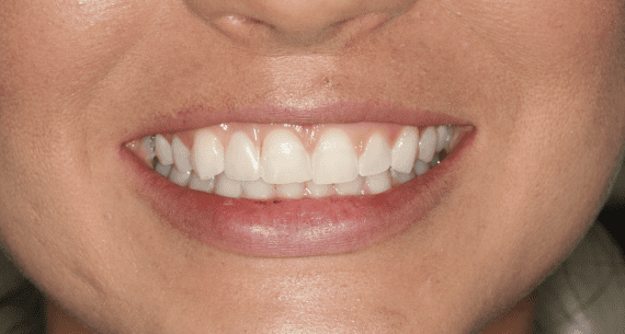 Home - Cosmetic Dentistry Center of San Diego